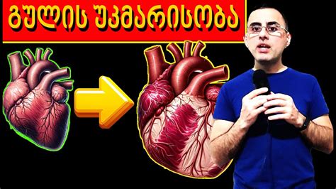 გულის უკმარისობის ტოპ 5 ნიშანი როგორ გავიგოთ რომ გულს უჭირს Youtube