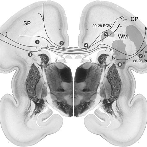 Growth Of Corpus Callosum Fibers Through Complex Guidance Zones And Download Scientific