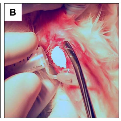 Lateral Radiographs Of A Defect In The Proximal Tibial Metaphysis Download Scientific Diagram