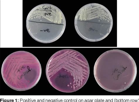 Figure 1 From Microleakage And Bacterial Adhesion With Three