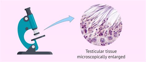 What Is A Testicular Biopsy Purpose And Procedure