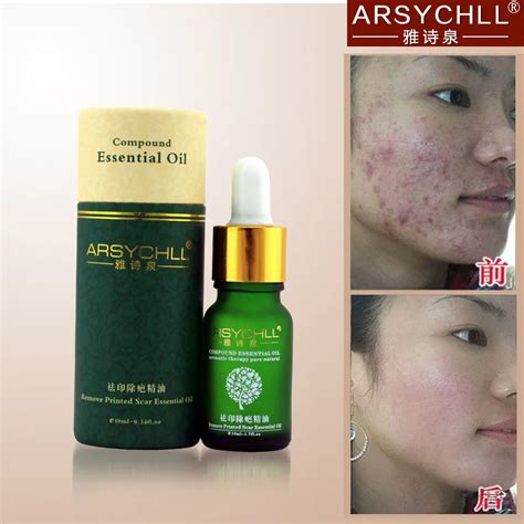Acne Scar Removal Cream In Bangladesh At Sandra Galvez Blog
