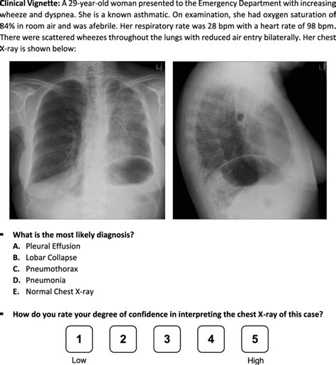 A Question From The Survey On A Left Upper Lobe Collapse Case Download Scientific Diagram