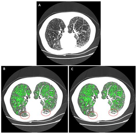 Bioengineering Special Issue Recent Advances In Biomedical Imaging