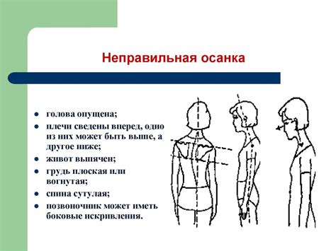 Правильная осанка - залог твоего здоровья - презентация онлайн