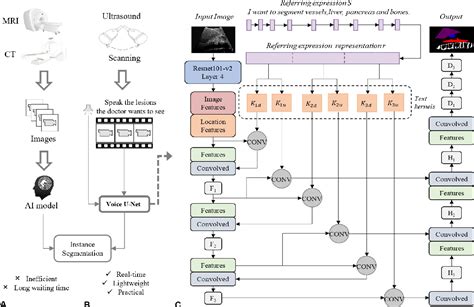 figure 1 from deep learning based real time segmentation in ultrasonic