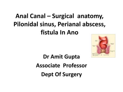 Analcanalsurgicalanatomypilonidalsinusppt
