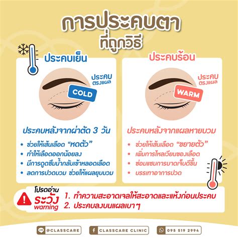 รู้หรือไม่ Classcare Clinic ทำตาสองชั้น