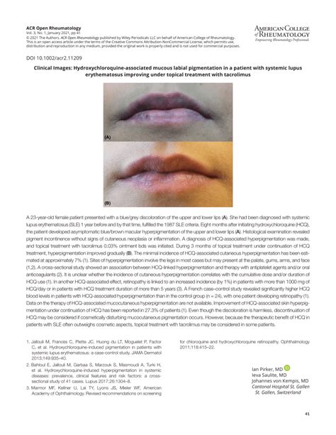 Pdf Clinical Images Hydroxychloroquine‐associated Mucous Labial
