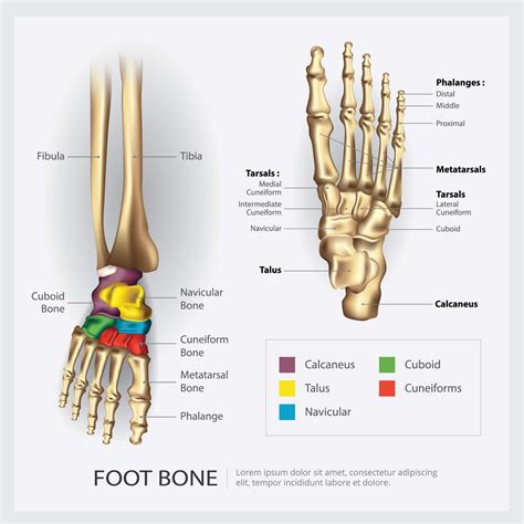 Cuneiform Bone Swelling