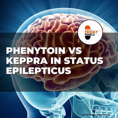 Fosphenytoin Vs Keppra For Status Epilepticus Pharmacy And Acute Care