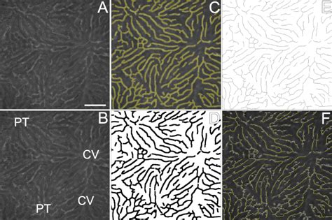 Spatial Temporal Analysis Of Fieldwise Flow In Microvasculature Protocol
