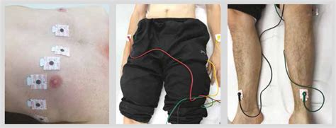 Journal Of Paramedic Practice Jpp Letters