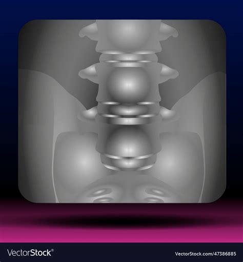 Lower Spine X Ray Royalty Free Vector Image Vectorstock