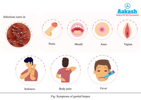 Gonorrhea Symptoms Biology