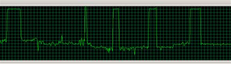 Performance SQL Server CPU Spikes Possibly Non Query Related Suggested Indicators