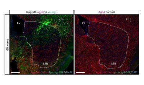 Stem Cell Podcast On Linkedin Young Glial Progenitor Cells