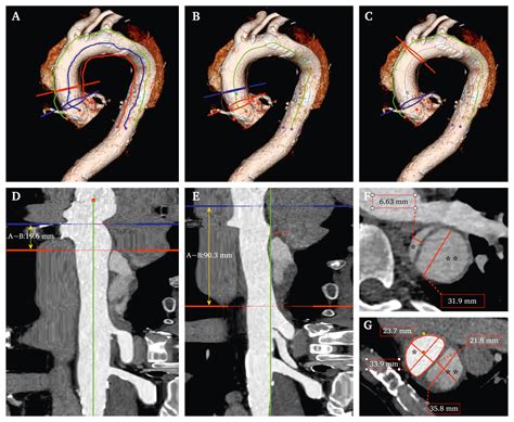 Editors Choice Sex Related Anatomical Differences In Patients With