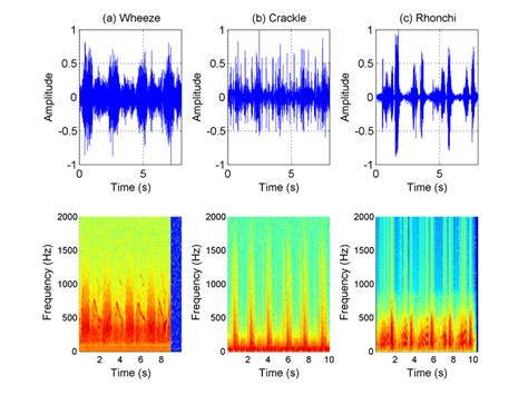 Adventitious Lung Sounds Als Waveforms Top And Spectrogram Bottom