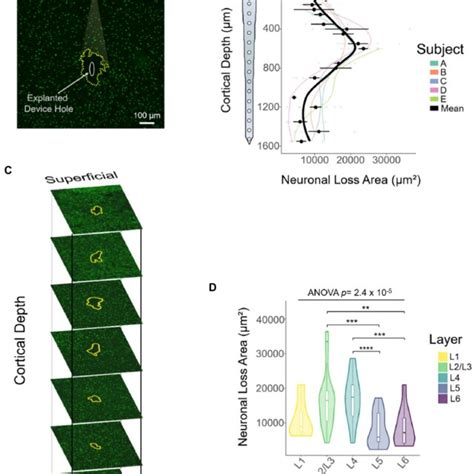 Quantification Of Neuronal Cell Loss Area Across Cortical Depth Using Download Scientific