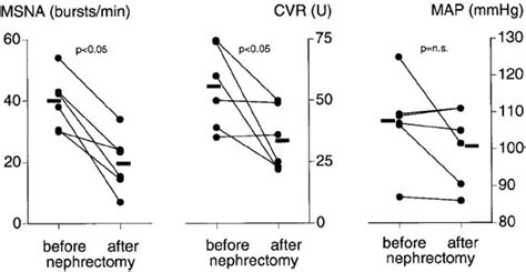 Effect Of Bilateral Nephrectomy On Sns Activity In Renal Transplant Download Scientific Diagram