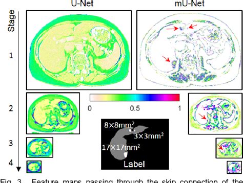 Figure 3 From Modified U Net Mu Net With Incorporation Of Object Dependent High Level Features