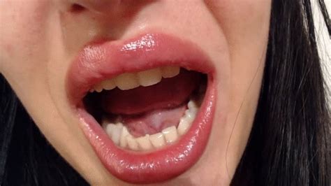 Close Up Ragged Teeth Fatalitas Ilusione Clips4sale