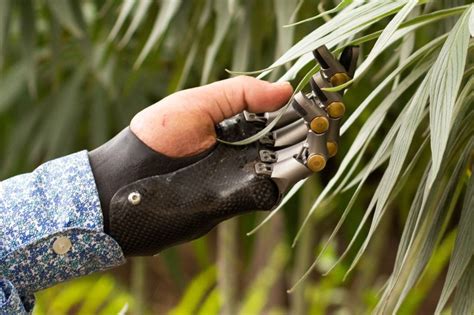 Prosthetic Options — Nxt Generation Prosthetics