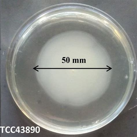 Motility Of E Coli Strains In A Semi Solid Agar Download Scientific