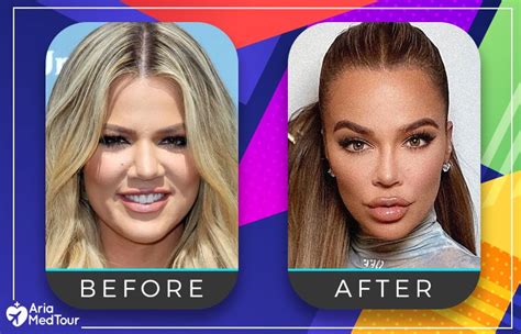 Celebrity Nose Job Before And After Women