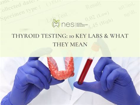 Thyroid Testing 10 Key Labs And What They Mean Natural Endocrinology Specialists