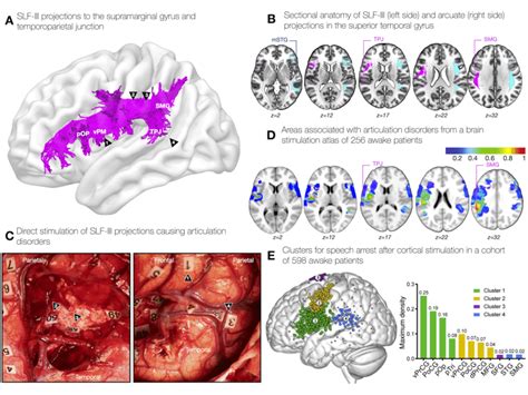 Anatomy Of The Third Branch Of The Superior Longitudinal Fasciculus