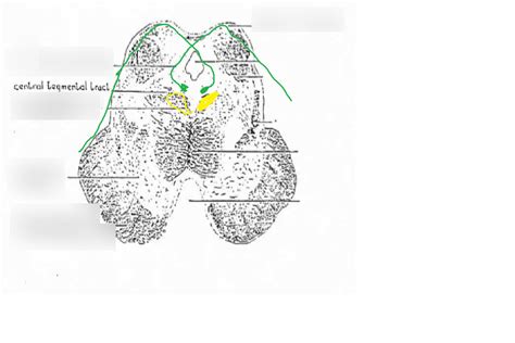Midbrain At Inferior Colliculus Diagram Quizlet
