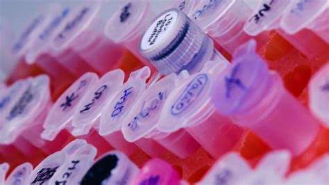 Pcr Reaction 스톡 사진 및 일러스트 Istock