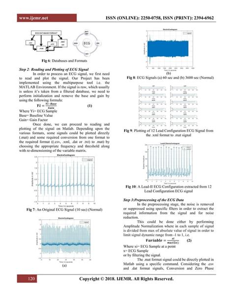 Classification Of Arrhythmia From Ecg Signals Using Matlab Pdf Classification Of Arrhythmia From Ecg Signals Using Matlab Pdf