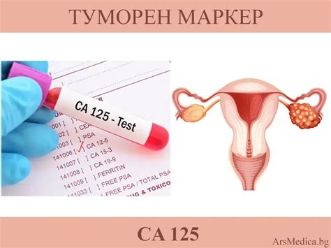 Висока пикочна киселина причини Arsmedica Bg