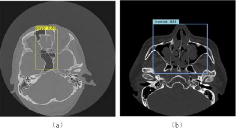 figure 8 from deep learning framework for preoperative recognition of