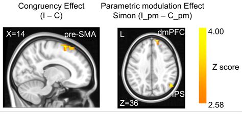 Figure 1 From Dorsolateral Prefrontal Activity Supports A Cognitive