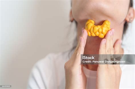 Woman Holding Human Thyroid Anatomy Model With Her Neck Hyperthyroidism Hypothyroidism Hashimoto