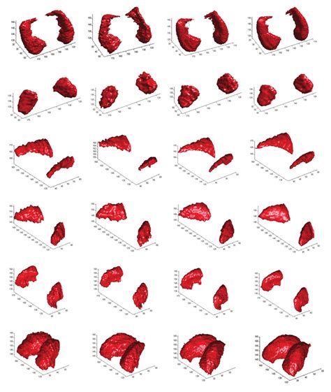 Results Of Manual Segmentation And Different Methods For Six Brain