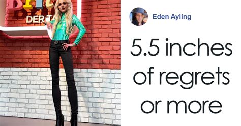 Model Who Spent 160k To Lengthen Her Legs By 55 Inches Left With