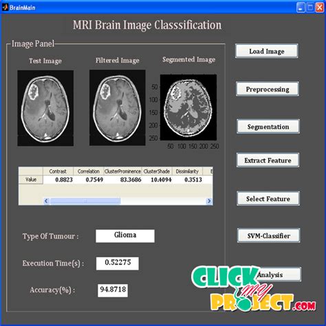 mri brain classification using support vector machine clickmyproject
