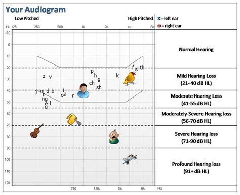 Understanding The Audiogram — Physicians Audiology Center