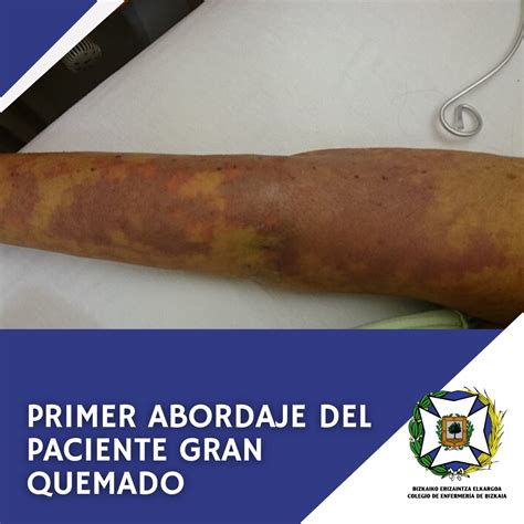 📢 El Colegio Presenta El Curso De Primer Abordaje Del Paciente Gran