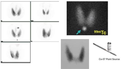 NUCM 320 Endocrine Images Flashcards Quizlet