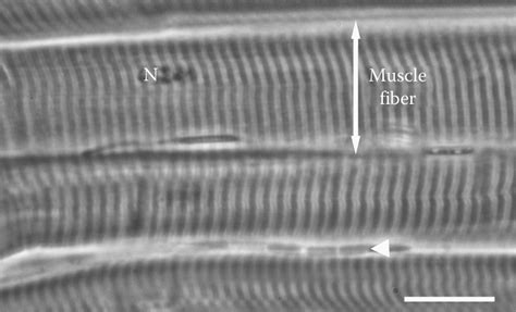 2 Light Micrograph Of A Longitudinal View Of Several Muscle Fibers