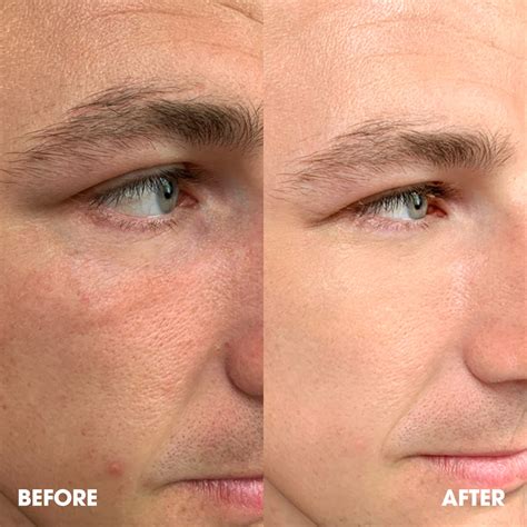 Lets Face It Bb Cream Tinted Moisturiser For Men Shakeup Cosmetics