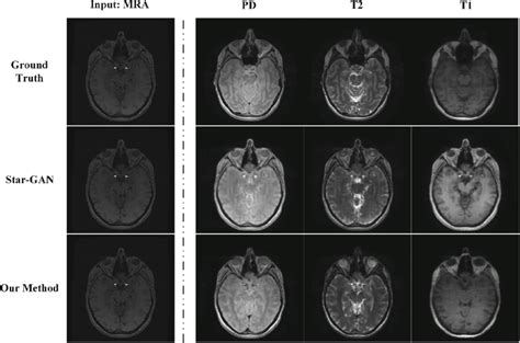 synthesis of pd t2 weighted and t1 weighted images using a single mra