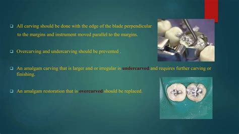 Class 1 And 2 Amalgam Tooth Preparation Pdf