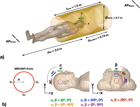 The Mri Scanner Bore Was Modeled As A Cylindrical Two Layer Impedance